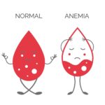 Iron Infusion: Benefits, Side Effects & What to Expect – ILUKA MEDICAL ...